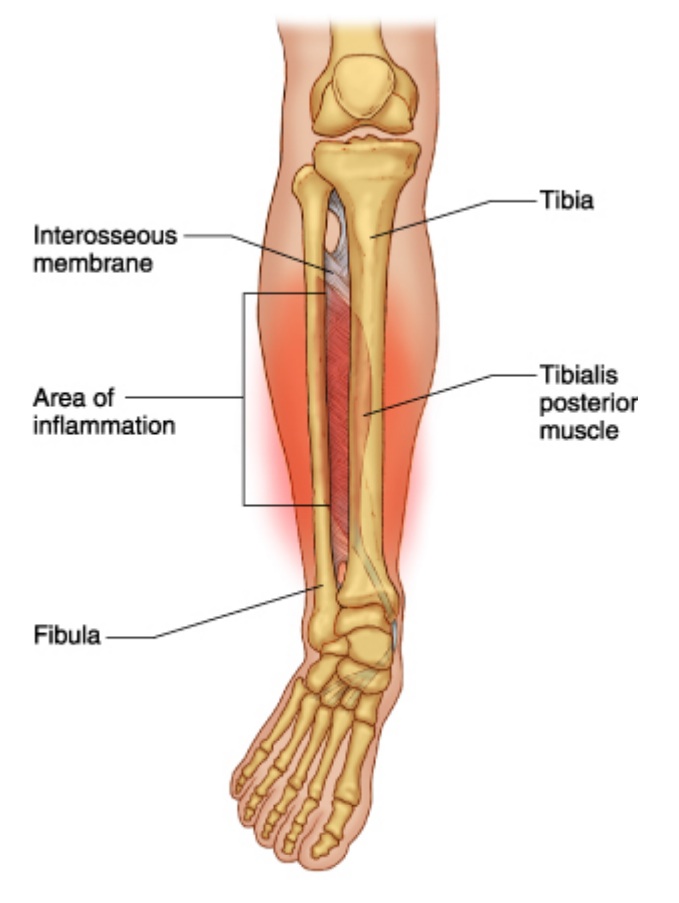 Childrens Problems Coquitlam Podiatry Foot And Ankle Clinic Coquitlam 